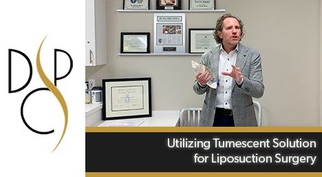 Utilizing Tumescent Solution for Liposuction Surgery - Dr. Steven Davis