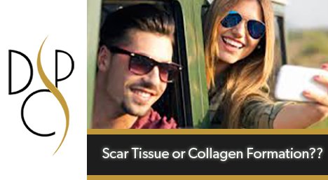 Scar Tissue or Collagen Formation?? | Dr. Steven Davis | Medical Podcast